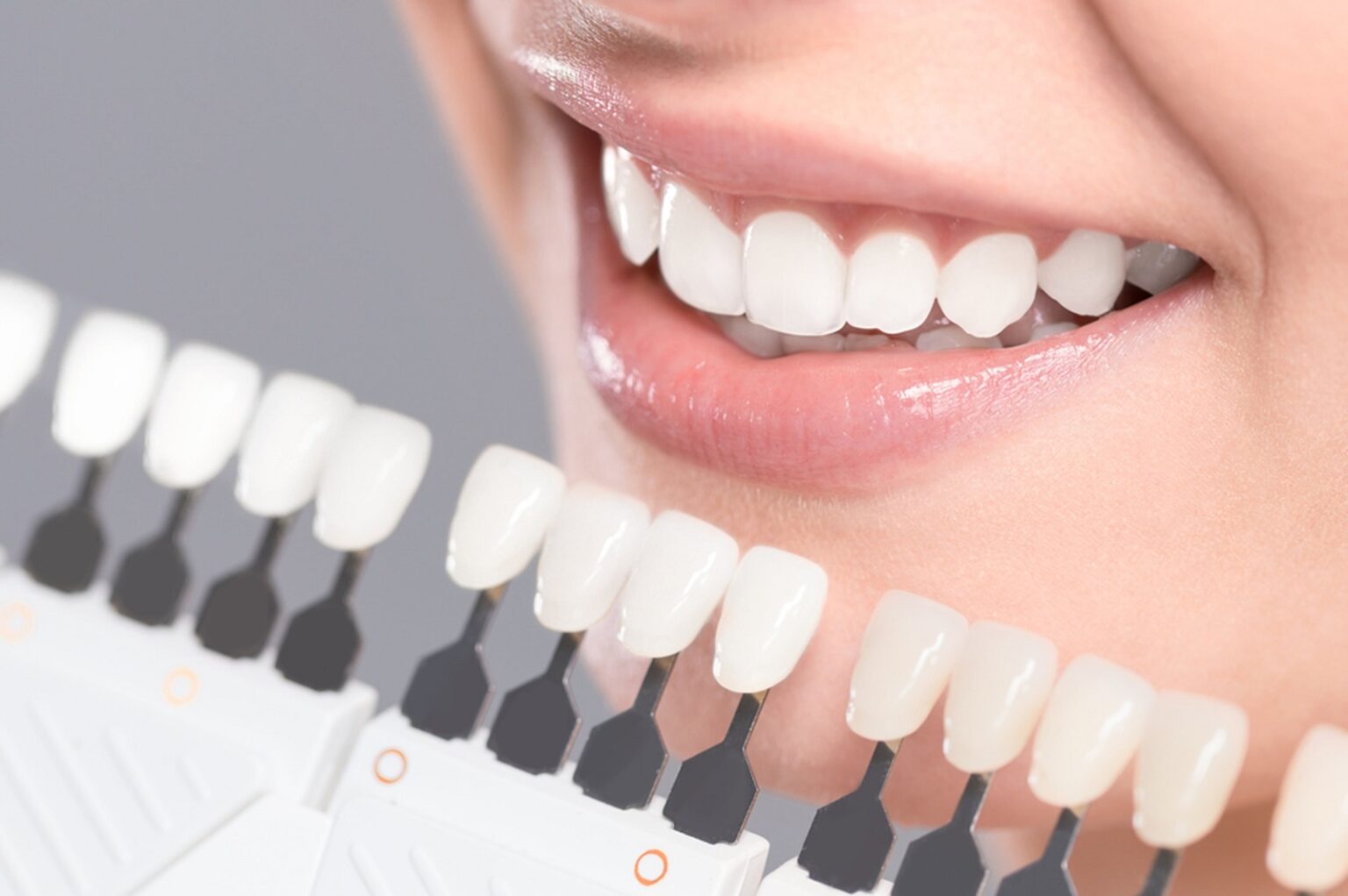 Why Won’t My Teeth Whiten? All You Need to Know About Teeth Whitening ...